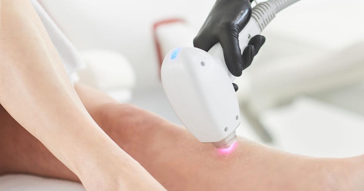 Épilation Définitive au laser diode - réservations près de chez vous ...